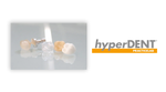 hyperDENT® | Dental CAM Software -Dentcore