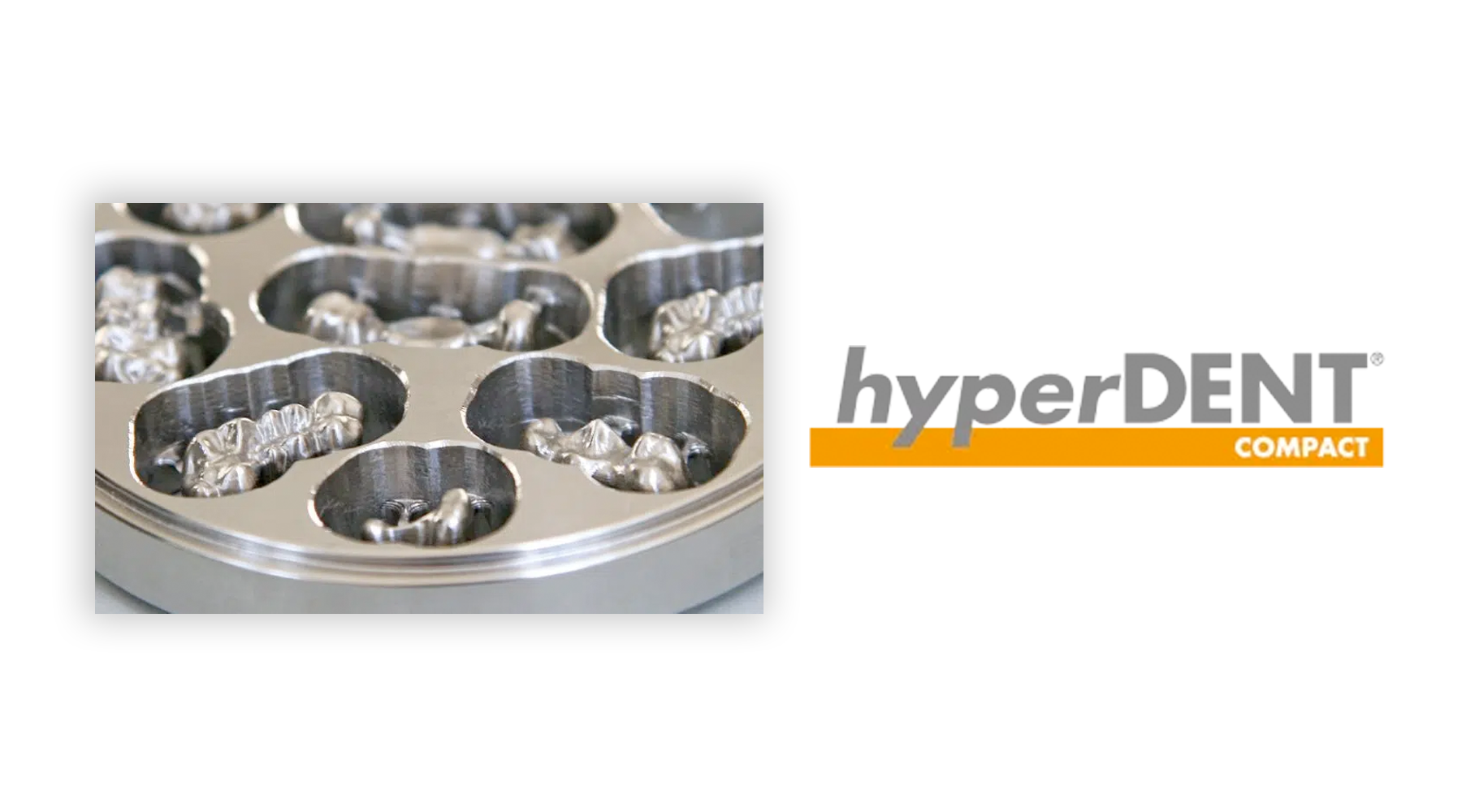 hyperDENT® | Dental CAM Software -Dentcore